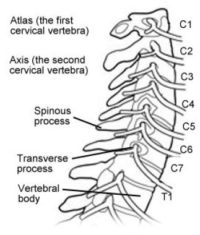 Types of cervical (neck) curves - Dallas Wellness Center